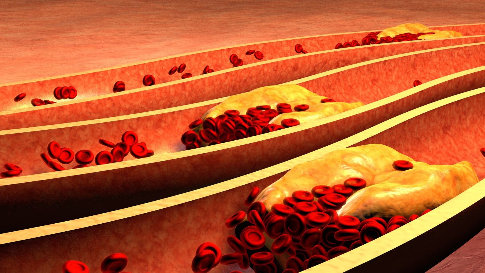 Know the Health Benefits of Navathaniyam or Whole Grains - Lifeandtrendz